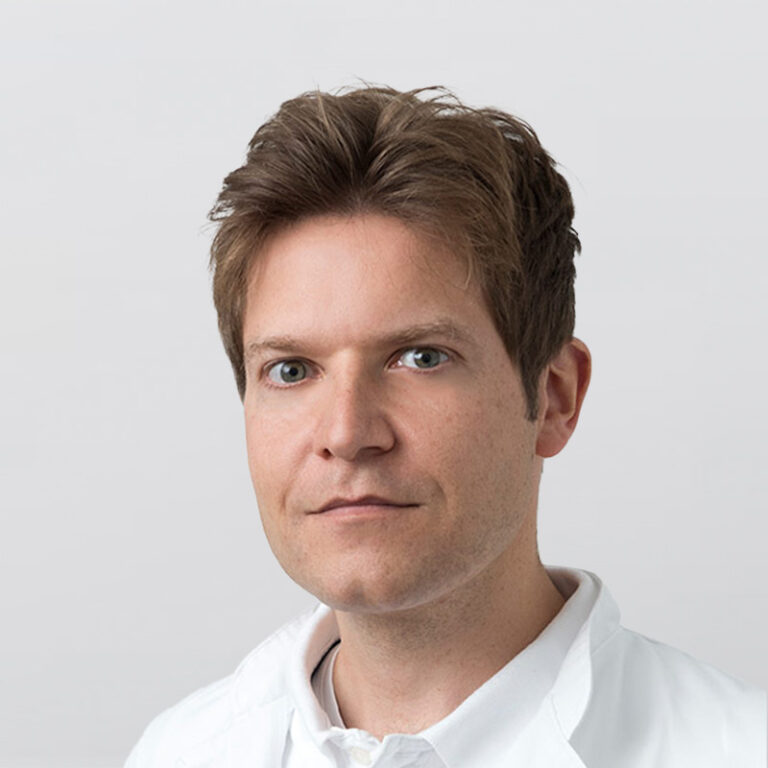 Pigmentflecken im Gesicht: Ursachen & Behandlung [+Tipps]