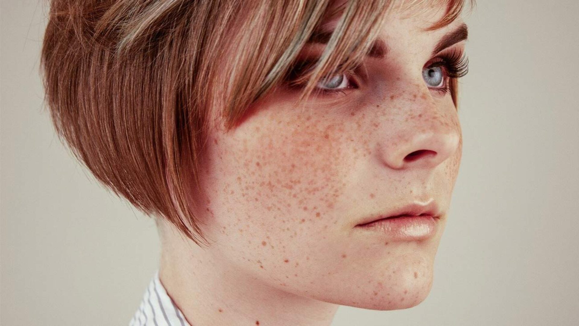 Pigmentflecken im Gesicht: Ursachen & Behandlung [+Tipps]